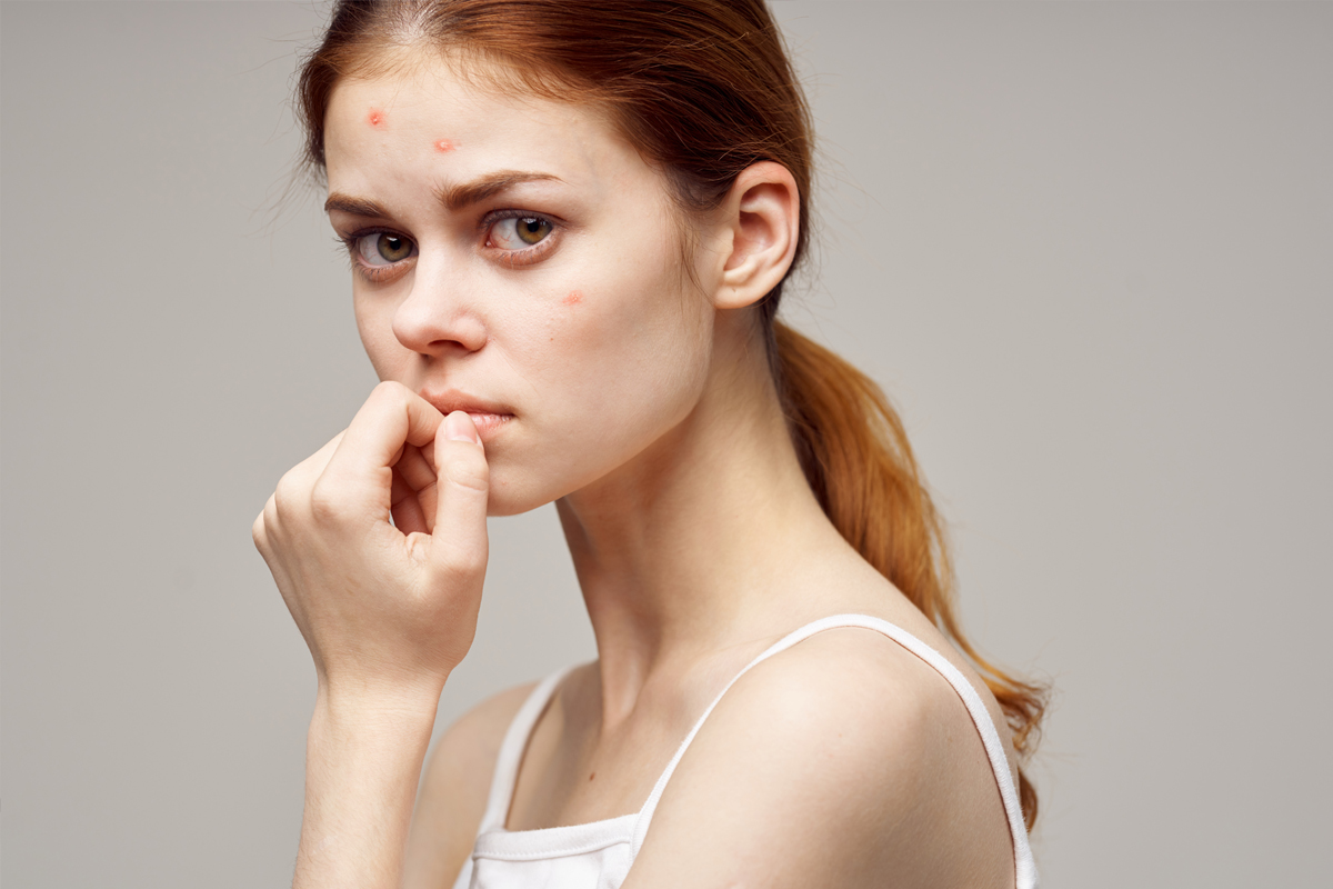 Junge Haut in Balance: Hautprobleme bei Teenagern verstehen und richtig ...